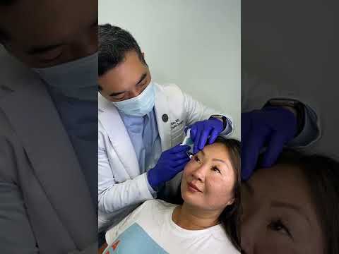 Fillers for your undereyes!