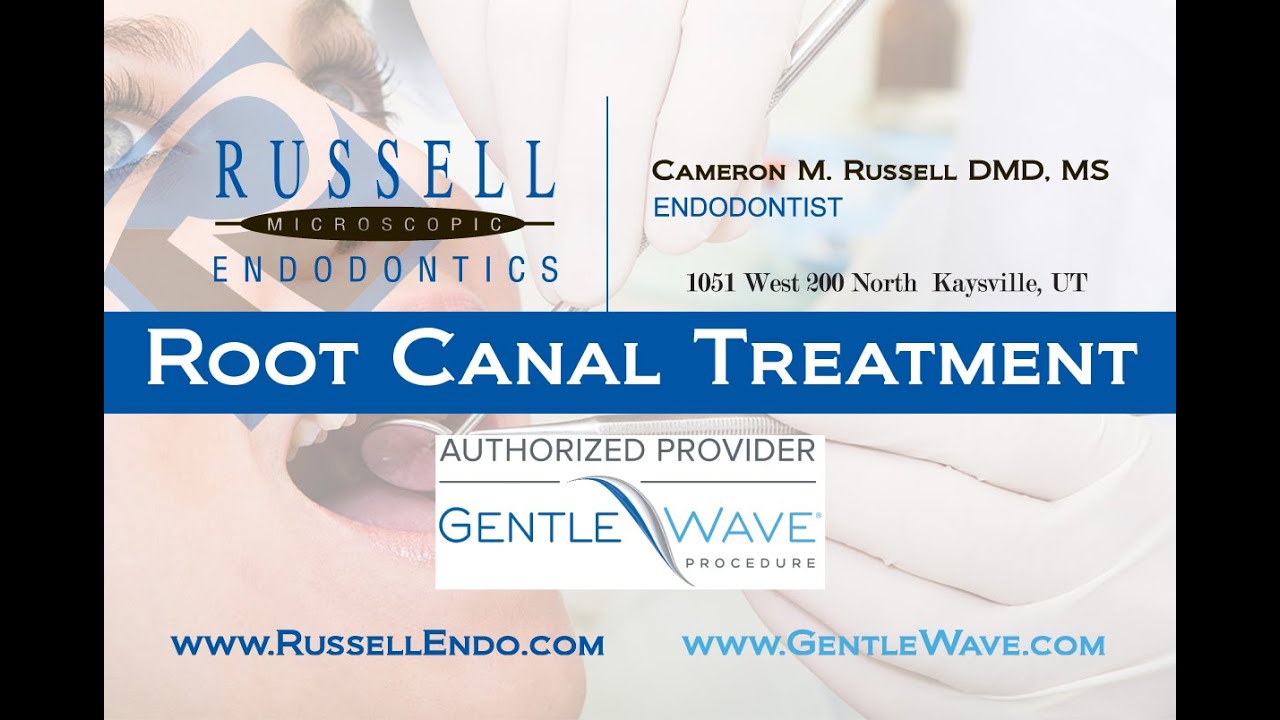 Russell Endodontics Root Canal Treatment, What is a Root Canal, why do I need a Root Canal