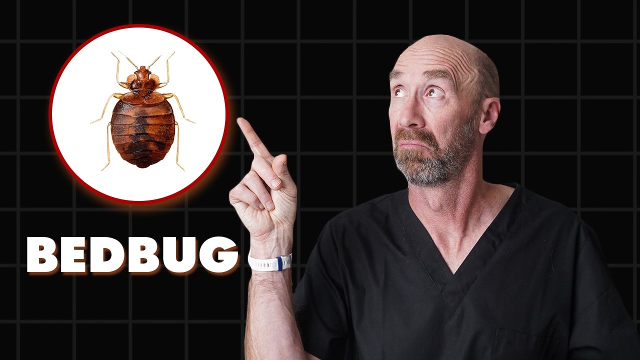 Doctor Explains BEDBUGS-including BITES, TREATMENT, REMOVAL