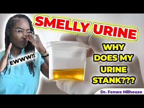 SMELLY URINE | CAUSES WHY YOUR URINE STANK | Dr. Milhouse