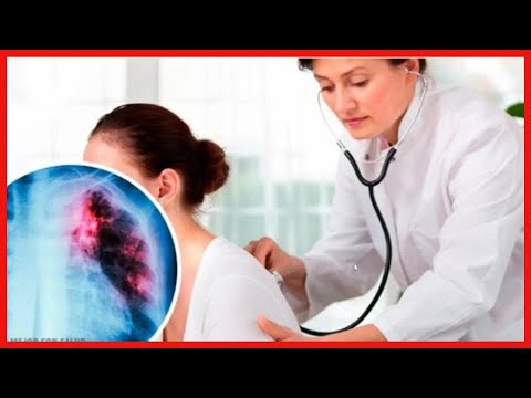 Qu'est-ce qu'un nodule pulmonaire ?