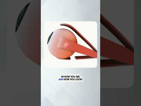 Squint Surgery