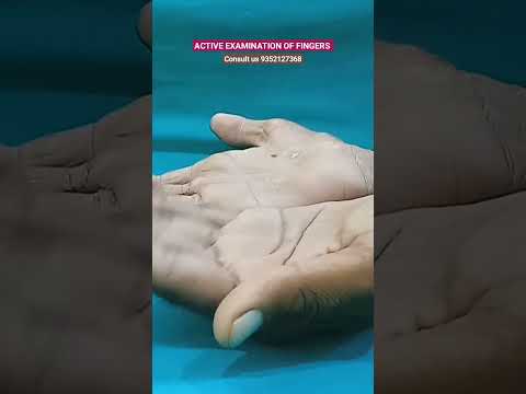 Active examination of fingers #physiotherapy #hand #movement #advice #pain #finger #stiffnes