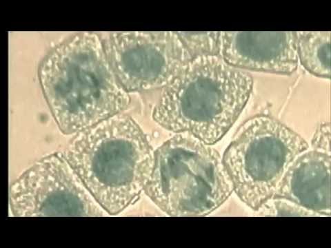 1.6 Skill: Identifying stages of mitosis under a microscope and on a micrograph