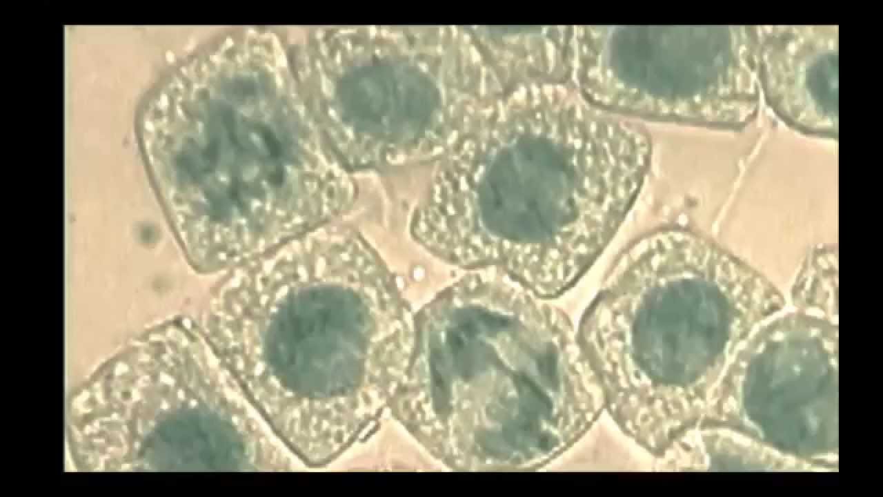 1.6 Skill: Identifying stages of mitosis under a microscope and on a micrograph