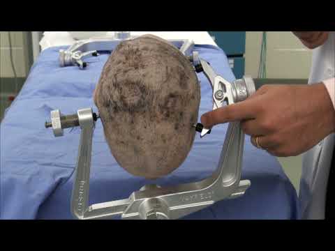 Mayfield Skull Clamp - Latest Price, Dealers & Retailers in India