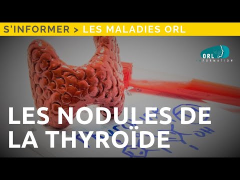 Information Patient | Les nodules de la thyroïde