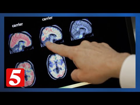 New Alzheimer's drug can delay patients' symptoms for several months