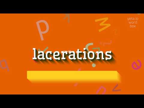 How to say "lacerations"! (High Quality Voices)