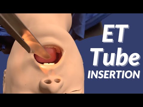 How to Insert an Endotracheal Tube (ET Tube)
