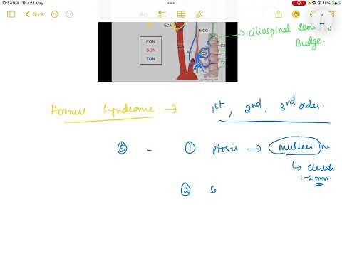 Horners syndrome diagnosis
