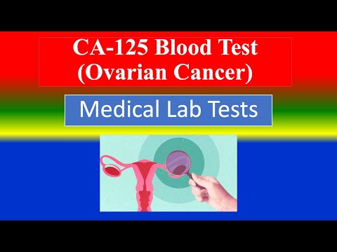 CA 125 Blood Test Ovarian Cancer - Medical Lab Tests - What is? Need , Preparation , Results