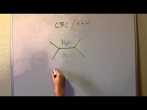 CBC or H/H Shorthand: Fishbone Diagram