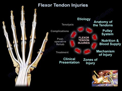 Flexor Tendon Injuries - Everything You Need To Know - Dr. Nabil Ebraheim