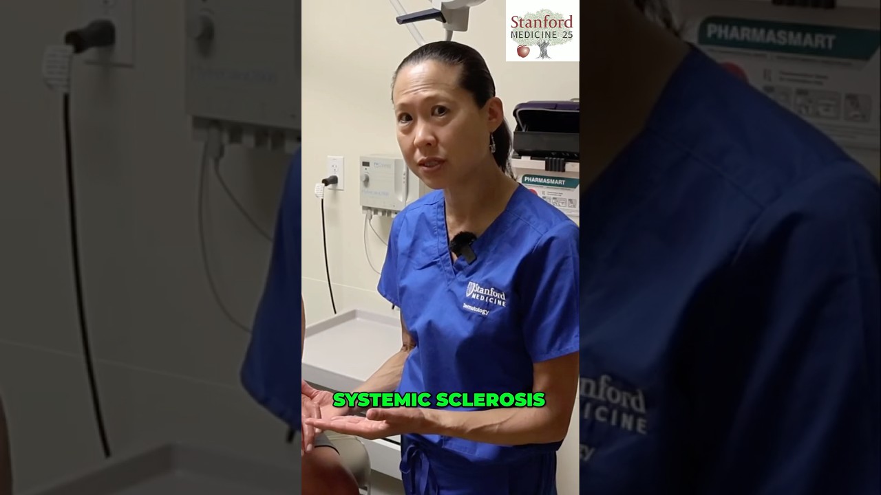 How to Diagnose SCLERODERMA