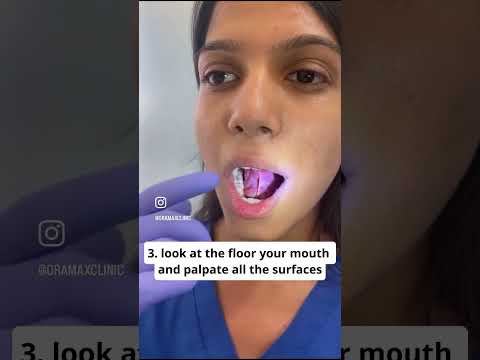 Oral Cancer Self Examination !! #oralcancerexamination