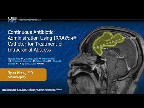 Published Case Review: Continuous Antibiotic Admin. Using IRRAflow for  Intracranial Abscess