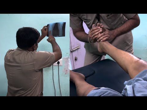 2 Years Knee Pain | Immediate relief was obtained | Varma Treatment | Tirunelveli