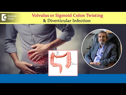 Colon Problems | Diverticular Disease in Sigmoid Colon - Dr. Rajasekhar MR | Doctors' Circle