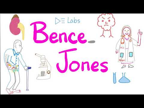 Bence Jones Proteins - Multiple Myeloma - Urine Test