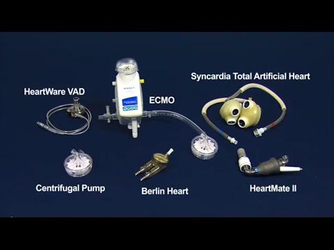 Ventricular Assist Devices (VAD) at Seattle Children’s Heart Center