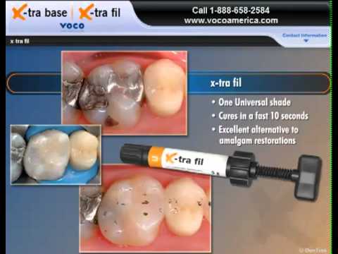 x-tra fil Tutorial Video