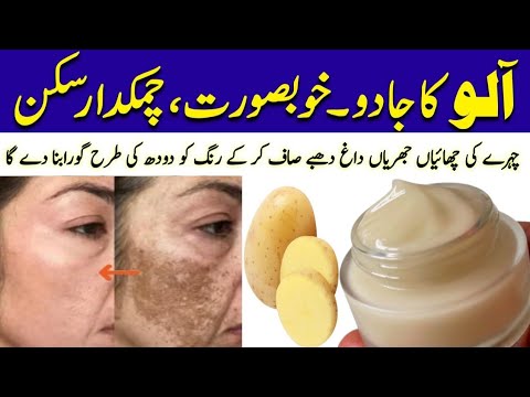 HOMEMADE POTATO CREAM |How To Make Potato Cream| Remove Dark Spot,Suntan,Pigmentation& Get Fair Skin