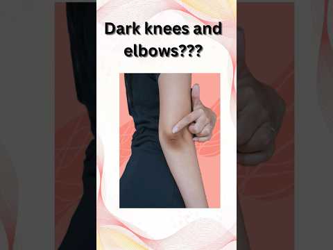 Worried about Dark knees and elbows? Here’s a solution to lighten them🌸🌸 read the pinned comment🥰