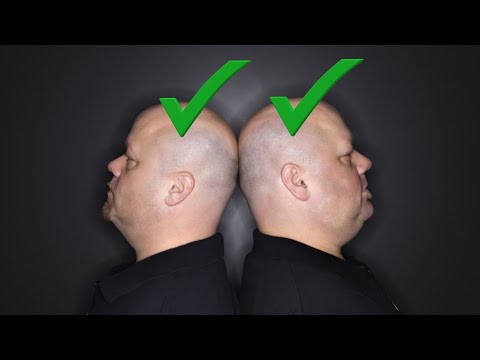 The Similarities Between NPD & BPD: Are They the Same?