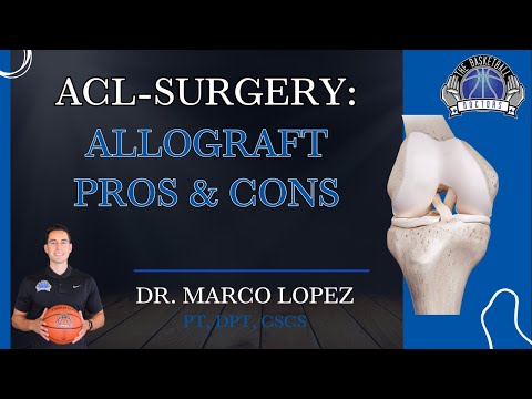 ACL Surgery Allograft (cadevar) Pros & Cons
