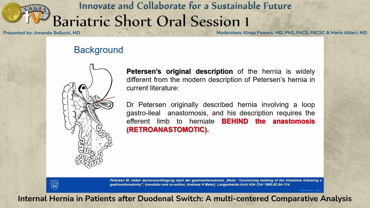 Internal Hernia in Patients after Duodenal Switch: A multi-centered Comparative Analysis