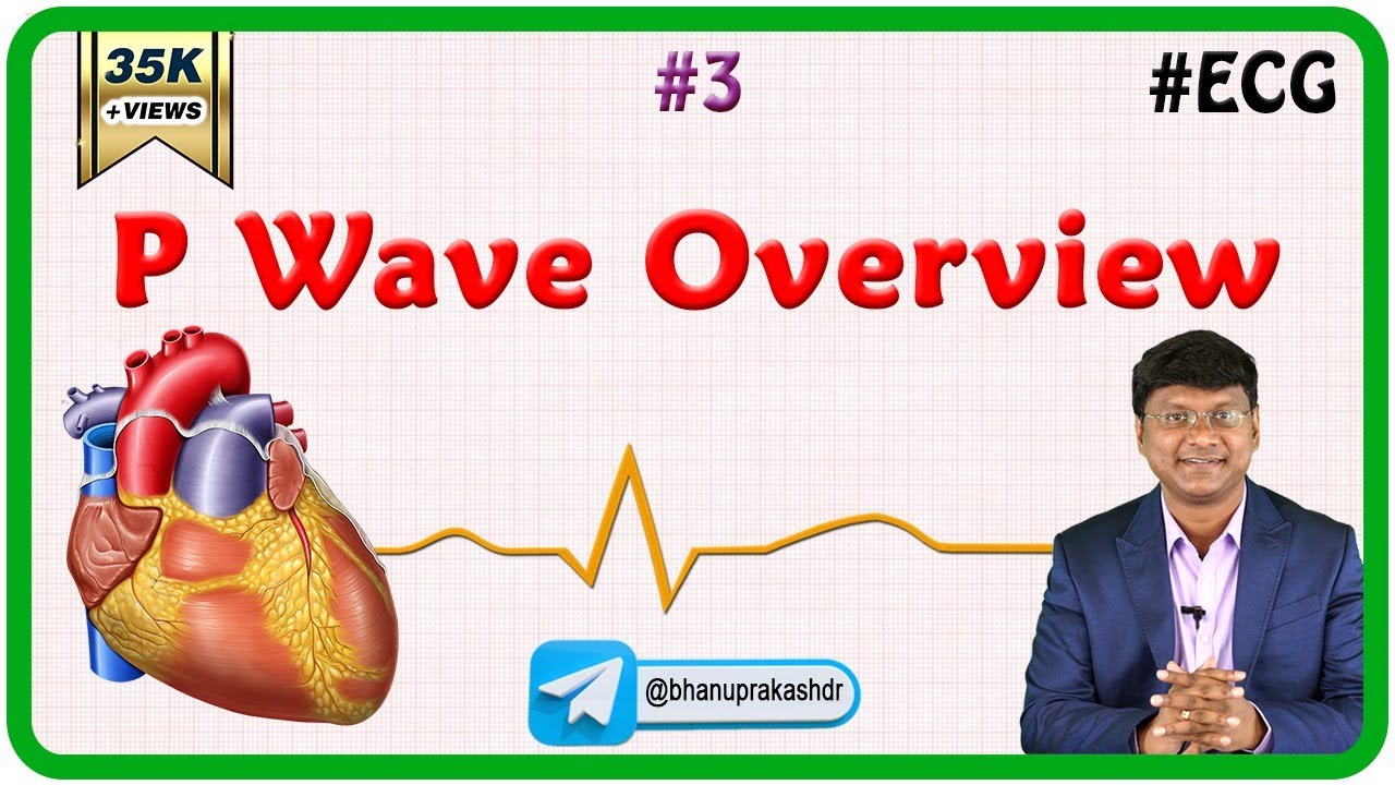 3. P Wave Overview - ECG assessment and ECG interpretation made easy