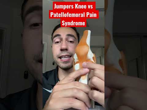 Jumpers knee vs patellofemoral pain (part 1) #shorts