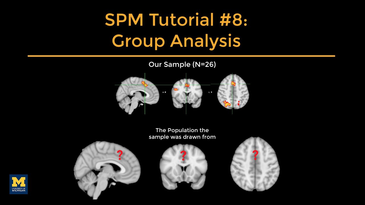 SPM Tutorial #8: Group-Level Analysis