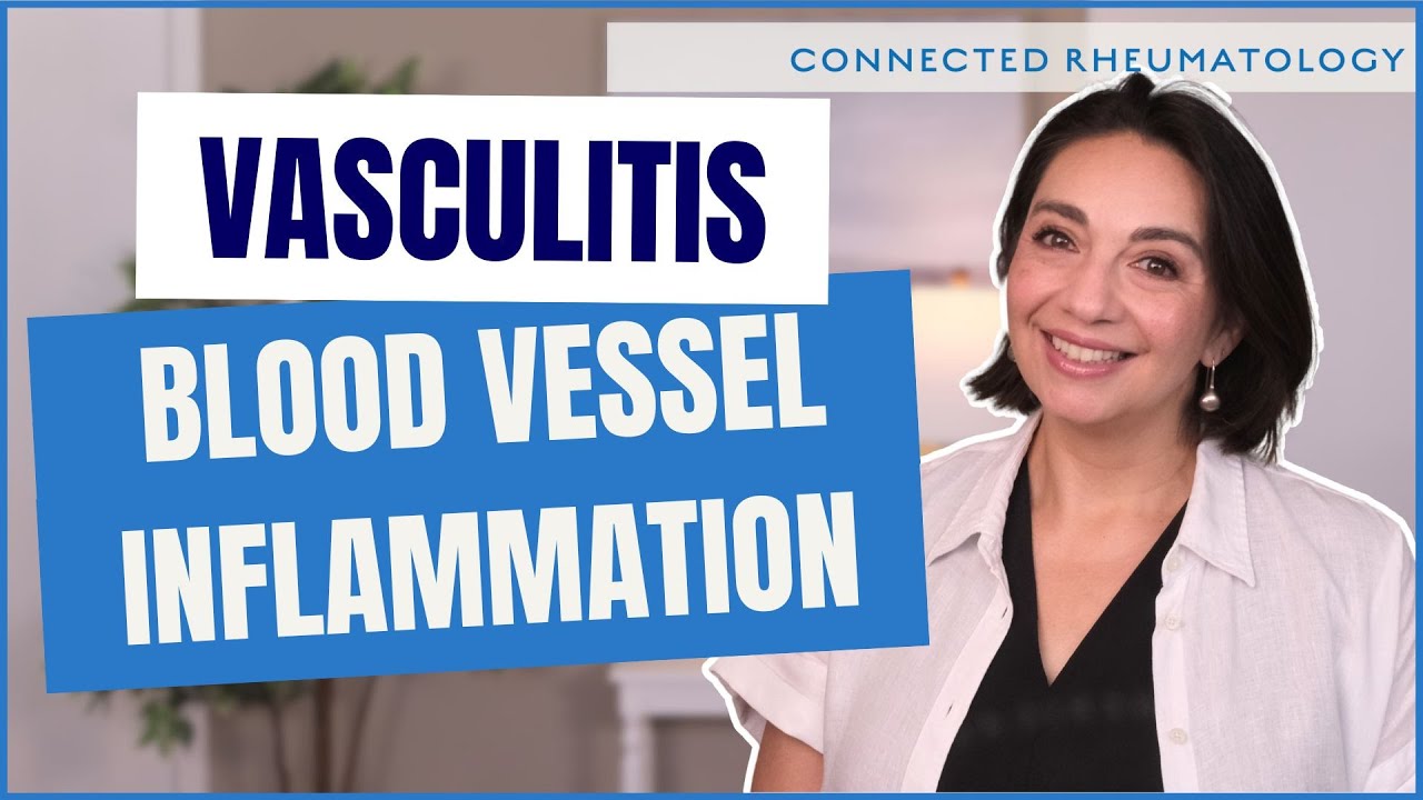 What is Vasculitis? Learn about this rare, but deadly autoimmune disease