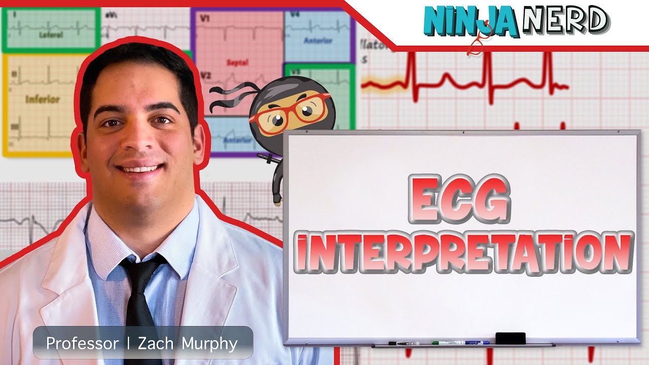 A Comprehensive Guide to ECG Interpretation for Clinicians | Galaxy.ai