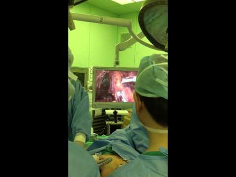 Prof.Kim Lap AR stump prep 1