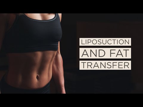 Liposuction and Fat Transfer: Why the VASERlipo Reigns Supreme