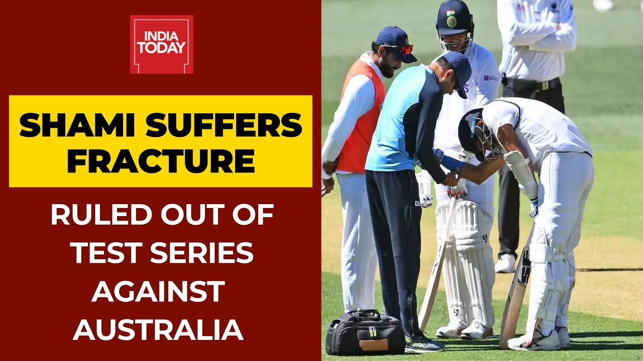 Mohammed Shami Ruled Out Of Test Series Against Australia Due To Fractured Arm