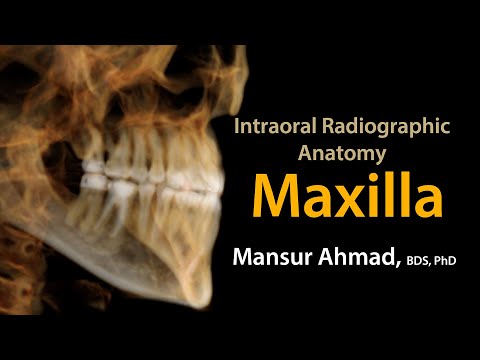 Intraoral Radiographic Anatomy of the Maxilla