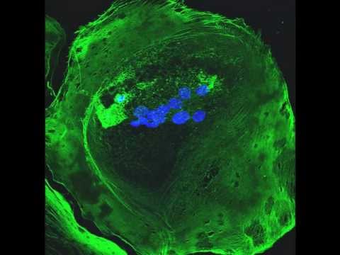 GM-CSF Treated Macrophages