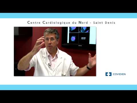 SCINTIGRAPHIE CARDIAQUE