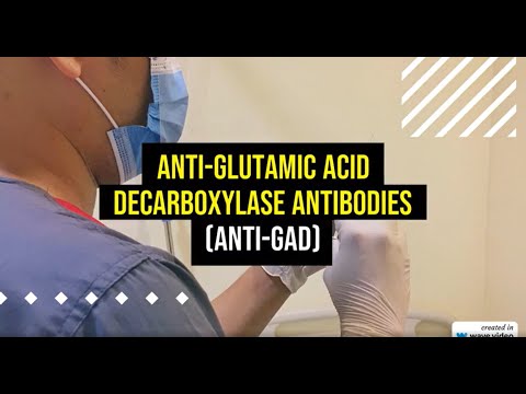Anti-GAD Antibodies: Impact on Type 1 Diabetes and SPS