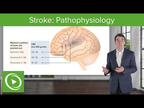 Stroke: Pathophysiology | Clinical Neurology