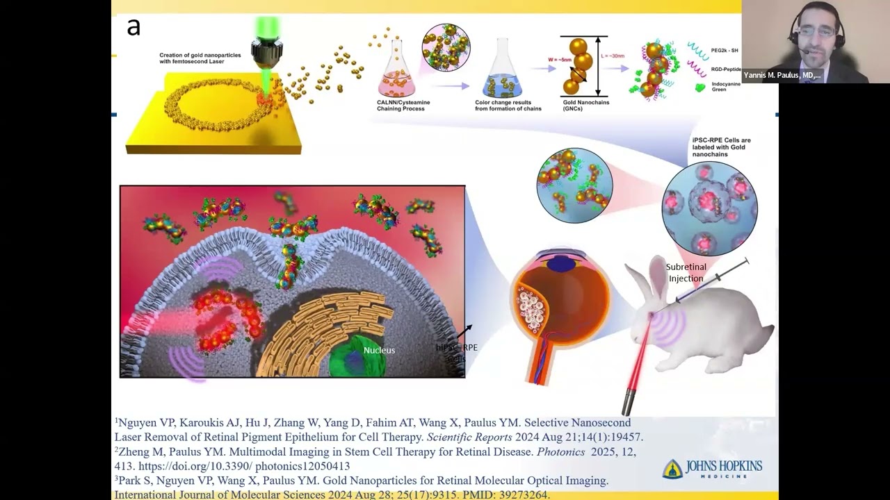 Rebuilding Vision: Regenerative Medicine and Clinical Trials in IRD and Dry AMD Webinar | 3/24/2026