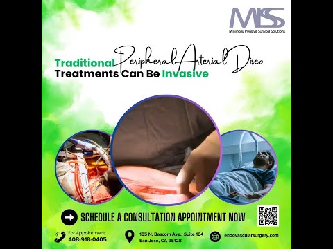Say Goodbye To Surgery, with Our Non-invasive PAD Treatments!