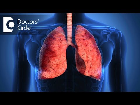 What are causes of Pulmonary Fibrosis? - Dr. Hirennappa B Udnur