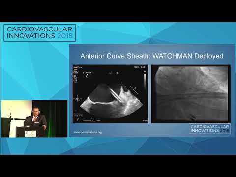 CVI2018 Session: Challenging LAA closure case with WATCHMAN - Rahul Sharma, MD