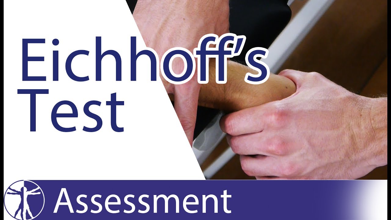 Eichhoff's Test | De Quervain's Tenosynovitis