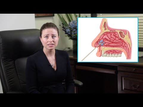 Nasal Cautery - A procedure to stop nose bleeding